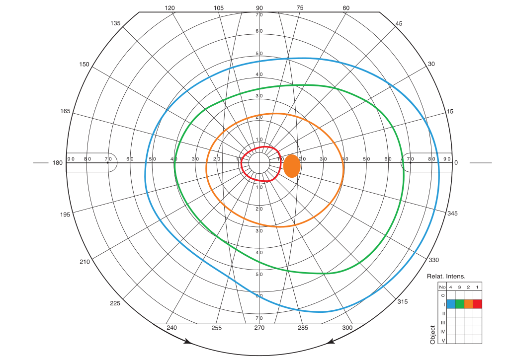 Methylphenidate Can Improve Visual Field Testing Outcomes